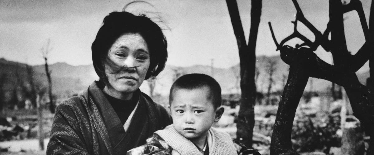 Hiroshima Radiation Birth Defects